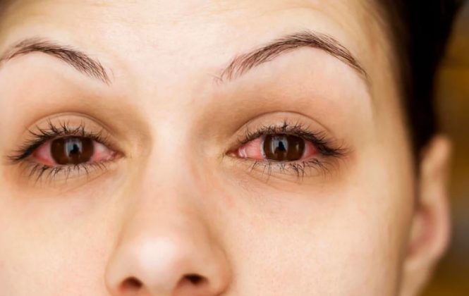 12 Bizarre Facts About Pee That Will Make You Cringe