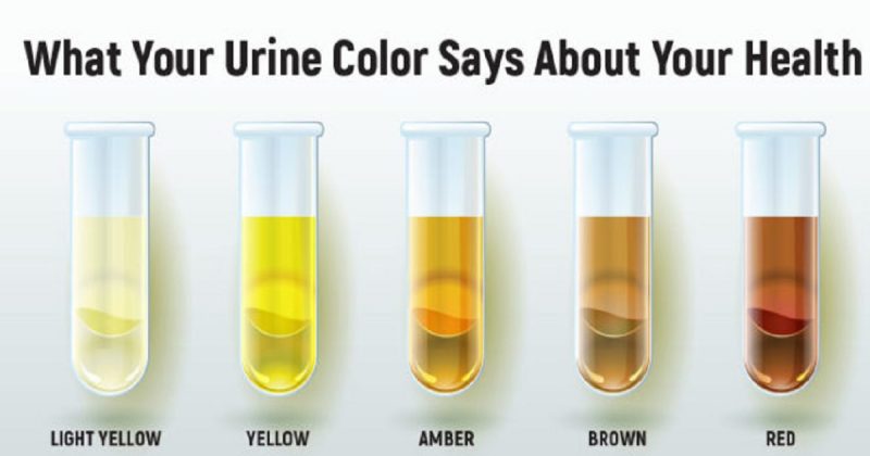Here's What The Color Of The Urine Says About Your Body - Filmymantra